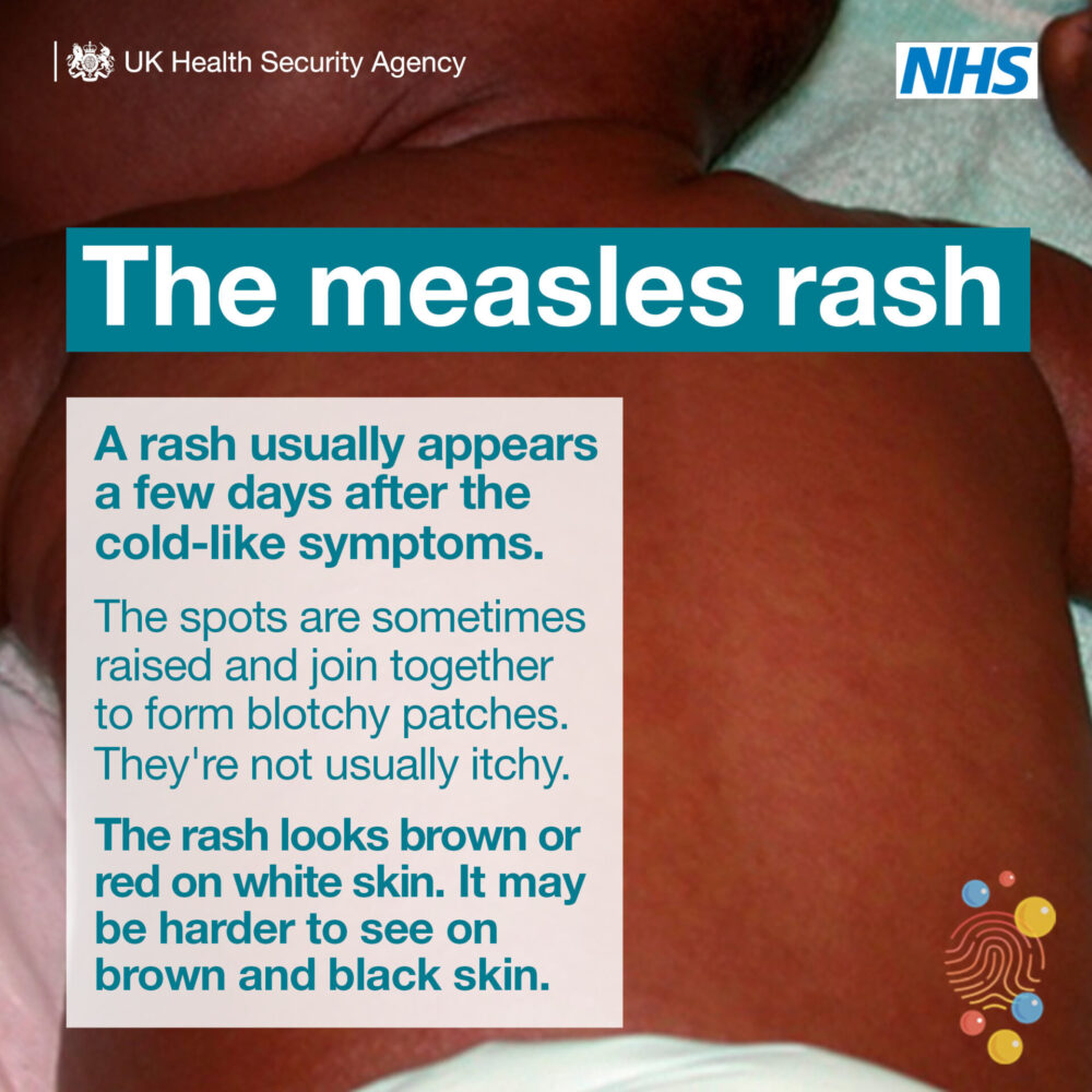 Resources for your patients - NHS Somerset ICB